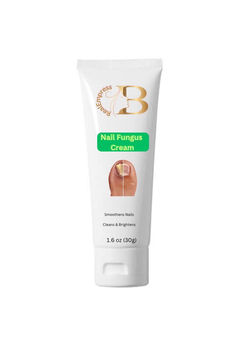 Nail Fungus Cream (30g) | Shop Today. Get it Tomorrow! | takealot.com