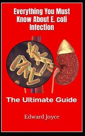 Everything You Must Know About E. coli Infection: The Ultimate Guide ...