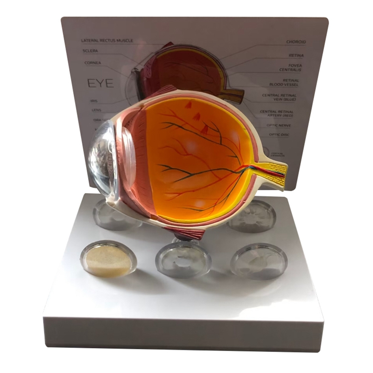 Eyeball Model Human Eye Demonstration Glaucoma Cataract Anatomy | Shop ...