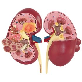 Hobby Human Organ Anatomy Natural Large Kidney Model - 13cm | Shop ...