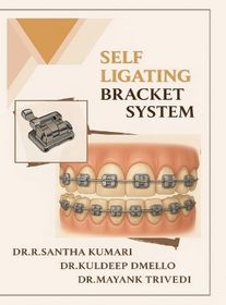 Self Ligating Bracket System | Shop Today. Get it Tomorrow! | takealot.com