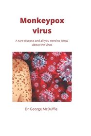 Monkeypox virus: A rare disease and all you need to know about the ...